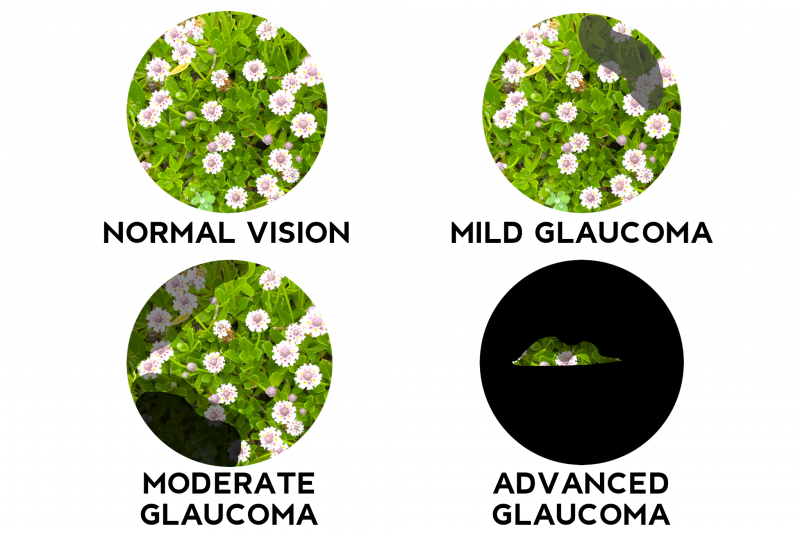 Huang Ophthalmology Center Inc. - Glaucoma
